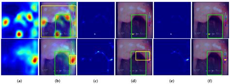 Visual Features For Improving Endoscopic Bleeding Detection Using Convolutional Neural Networks
