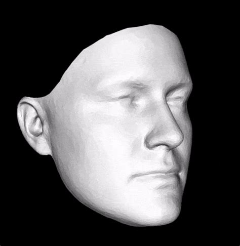 Facial Morphology Models For Genetic Syndrome Diagnosis Miplab