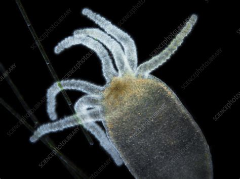Hydra Polyp Light Micrograph Stock Image C0584357 Science Photo