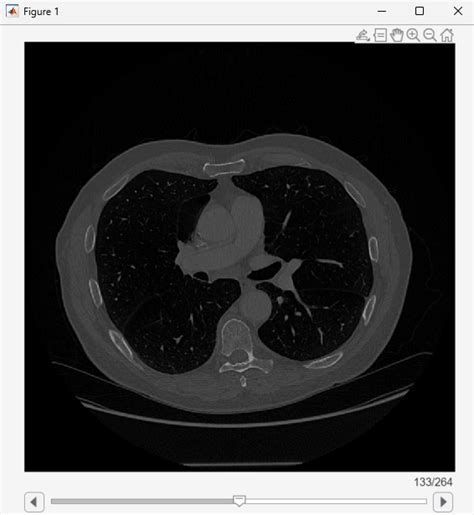 Sliceviewer Browse Slices Of Medical Image Volume In Patient