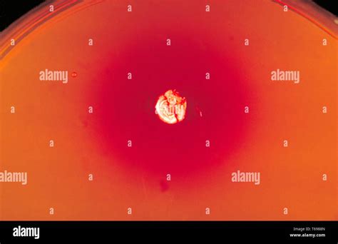 Close Up Photograph Of The Dermatophyte Test Medium Dtm Agar Plate Culture Growing The Fungus