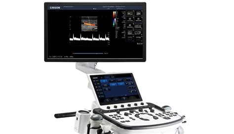 Xbit 90 Elevating Imaging Excellence With Premium Ultrasound Technology
