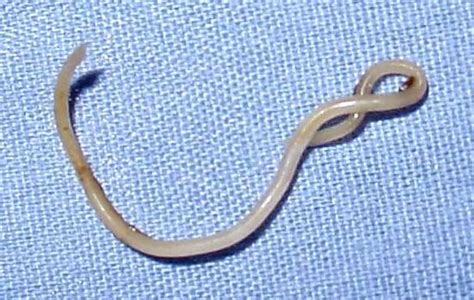Types Of Parasitic Worms