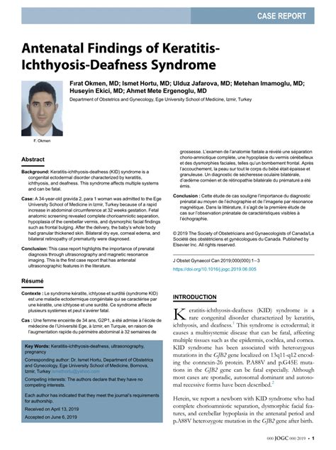 Pdf Antenatal Findings Of Keratitis Ichthyosis Deafness Syndrome