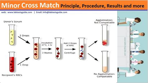 Minor Cross Match Procedure Principle Results And More Artofit