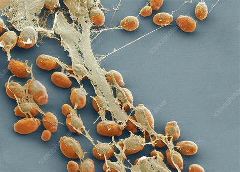 Nets Trapping Yeast Spores Sem Stock Image P2660131 Science