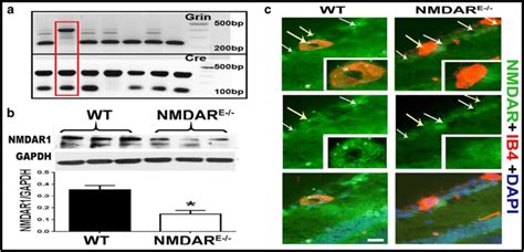 Mouse With Genetic Deletion Of Nmdar Nmdare−− Mice Deficient In