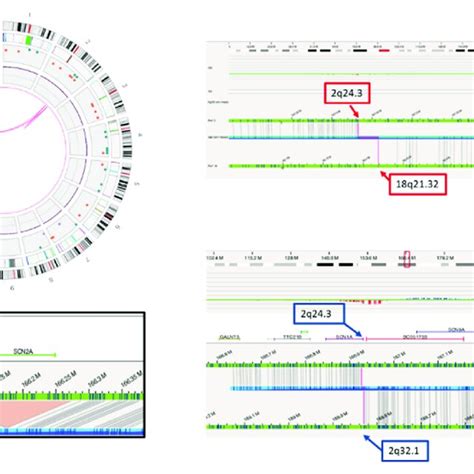 Complex Genomic Rearrangements Cgr Disclosed By Optical Genome