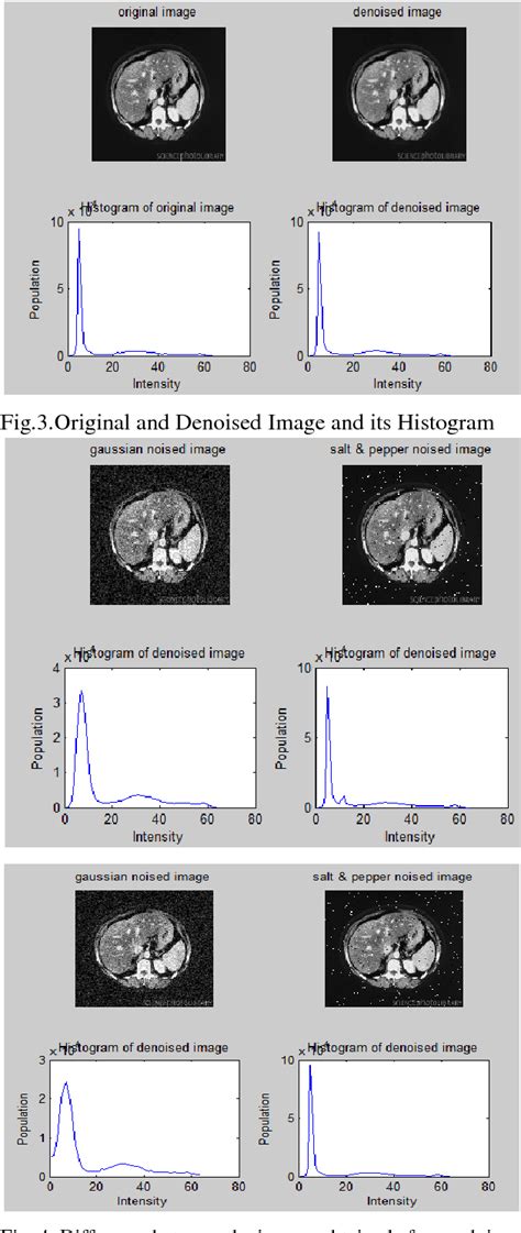 Figure 4 From Liver Segmentation Of 3d Ct Scan Images Using Parallel Processing Semantic Scholar