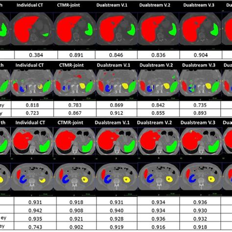 segmented ct images examples from dual‐stream models ct computed