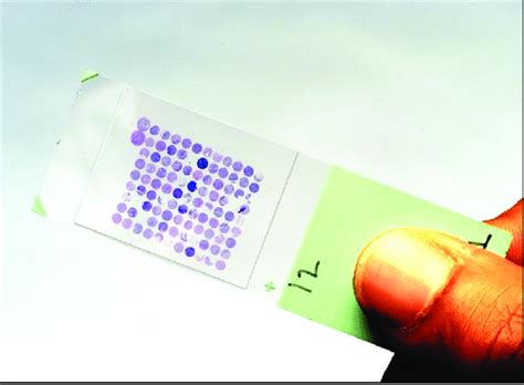 A Tissue Microarray Slide Download Scientific Diagram