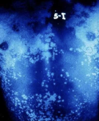 Derm Final Flashcards Quizlet