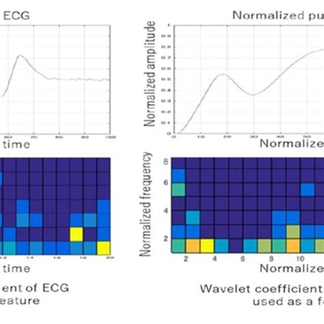 Examples Of The Wavelet Transformation Of The Ecg And Pulse Download Scientific Diagram