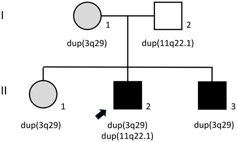 3q29 Microduplication Syndrome New Evidence For The Refinement Of The