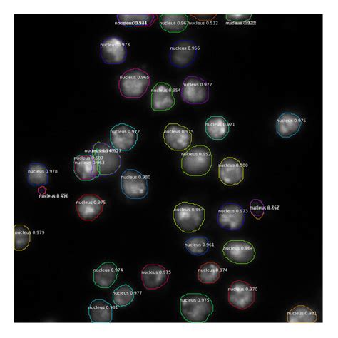 Github Casillasalba 2018 Data Science Bowl The 2018 Data Science Bowl Offers A Mission