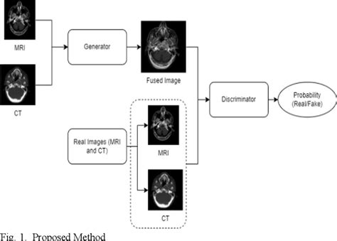 Figure 1 From Development Of Multimodal Fusion Technique For Medical Images Semantic Scholar
