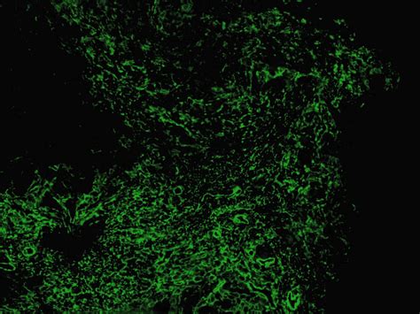 Colocalization Analysis Using Coloc2 In Fijiimagej Issue Researchgate