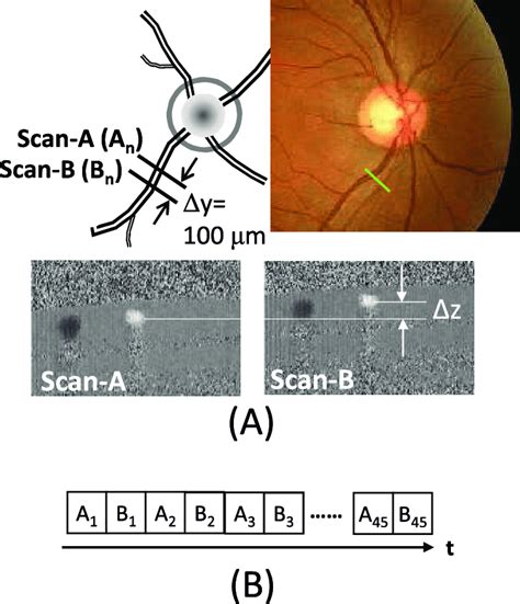 Schematic Diagram Of Real Time Doppler Angle Measurement A The Two Download Scientific