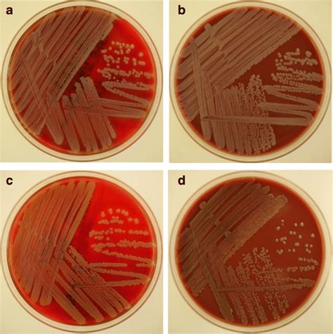 Colonies Of Staphylococcus Argenteus After 24 H Of Incubation At 35 °c Download Scientific