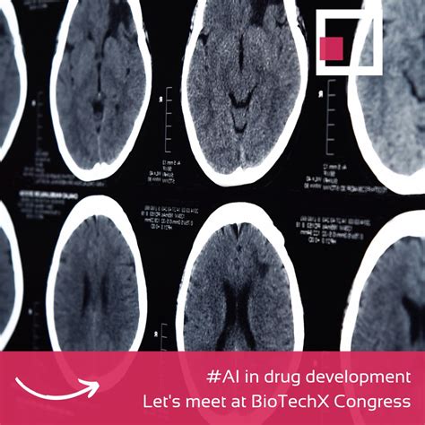 Graylight Imaging On Linkedin Brain Tumor Segmentation Challenges Graylight Imagings Success