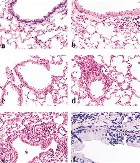 Histopathology Of Fvb Nj And Fvb N Tg5 Mice Lung Histology Of Fvb Mice