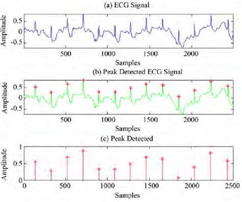 R Peaks Detection Using Ppt Download Scientific Diagram