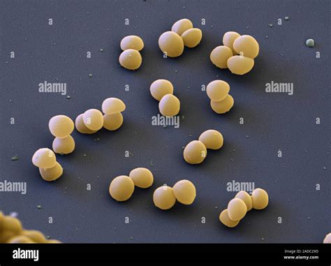 Staphylococcus Lugdunensis Bacteria Coloured Scanning Electron Micrograph SEM This Gram