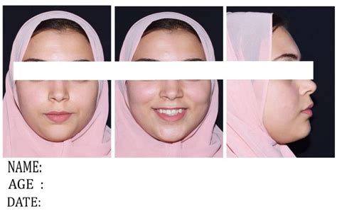 Ahmed Marzouk On Linkedin Ortho File Photography