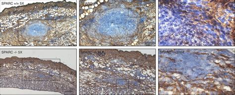 Collagen Iv Staining Reveals Disorganized Collagen Deposition And More Download Scientific