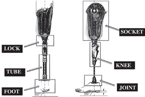 Trans Femoral Or Above The Knee Prosthesis Frontal Left And Lateral Download Scientific