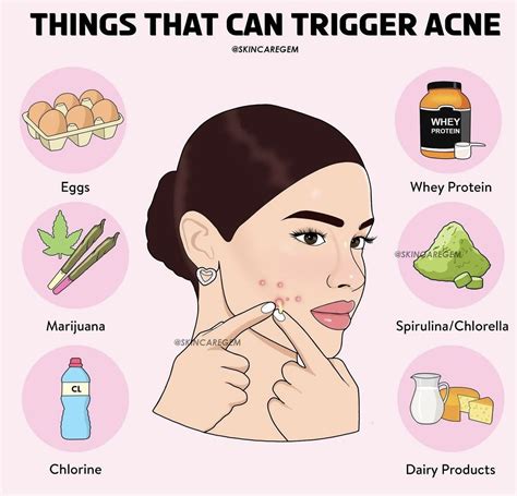 Face Mapping Acne Chinese Causes And Remedies Of Acne Artofit