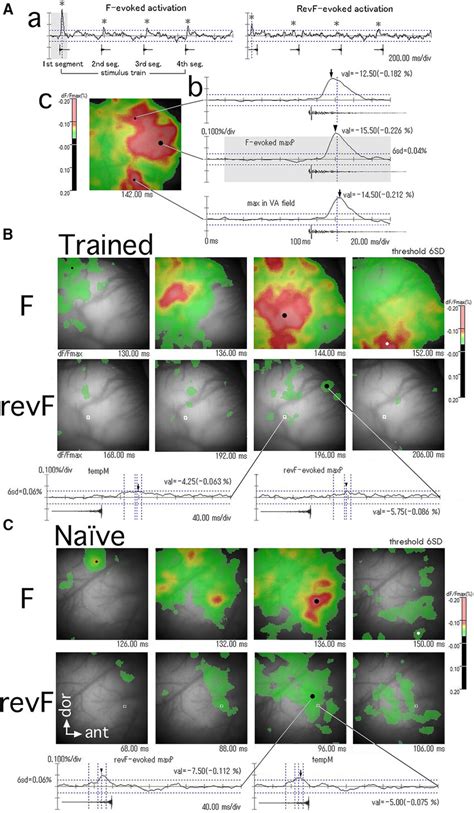 Temporal And Spatial Patterns Of Activation Evoked By The Temporally