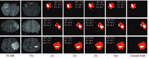 Examples Of The Segmentation Results On Full Modalities On Brats 2019