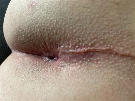 Inspect My Butthole 7 Nude Pics XHamster