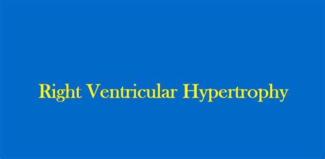 Topic Electrocardiographic Findings 12 Lead Ecg Certification