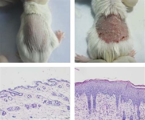 Serpinb3a Is Highly Expressed In Imiquimod Imq Induced Psoriasis Like Download Scientific