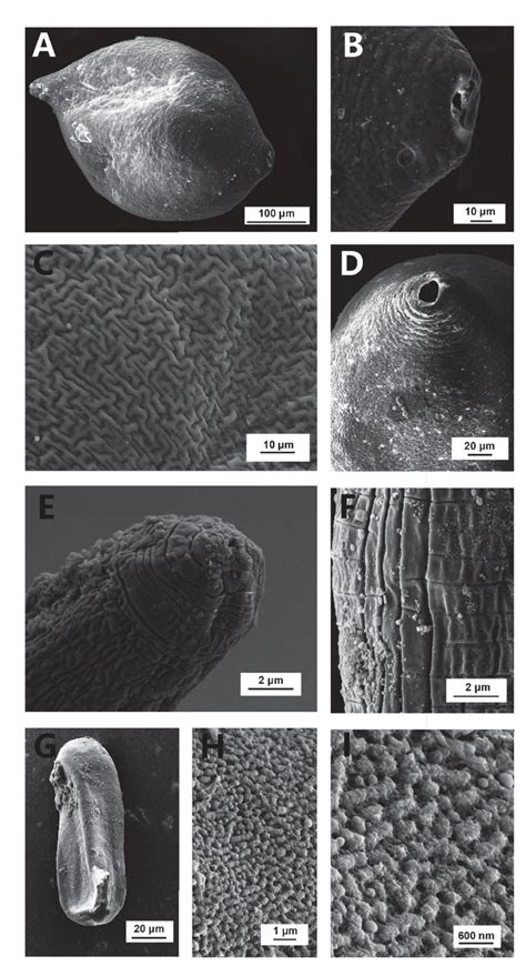 Sem Micrographs Of Cactodera Chenopodiae N Sp A Cyst B Vulval Cone Download Scientific