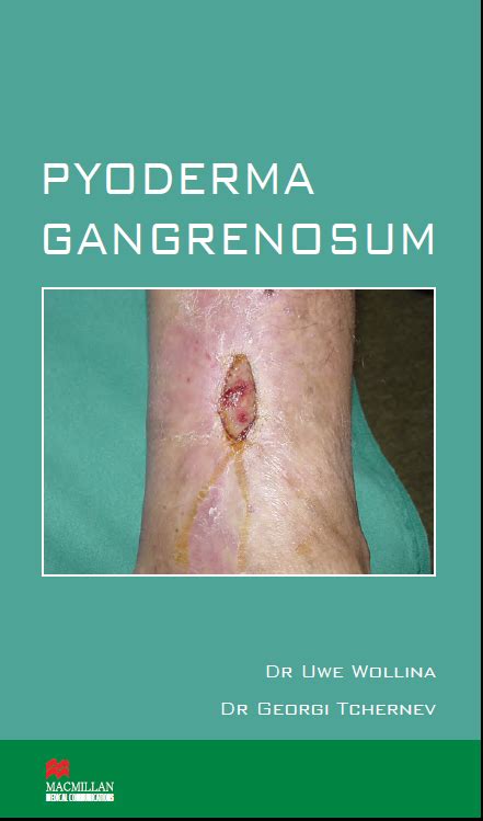 Pdf Pyoderma Gangrenosum