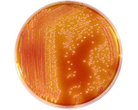Bacterium Lactis Aerogenes что это