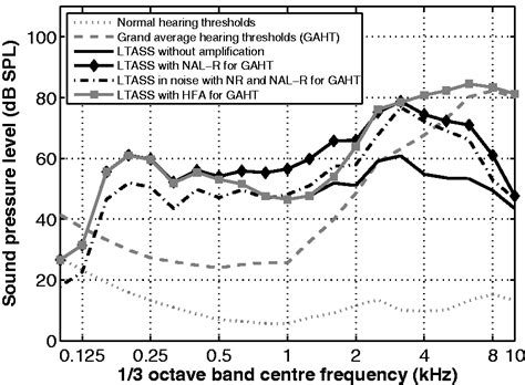 Illustration Of The Acoustic Effects Of The Different Hearing Aid