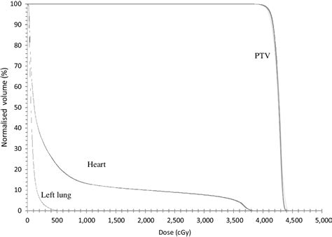 retrospective analysis of portal dosimetry pre treatment quality