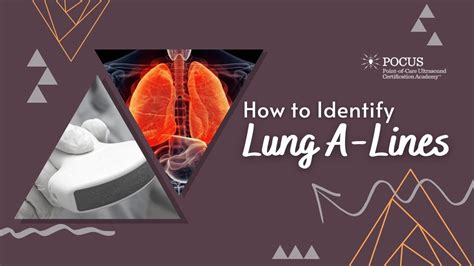 How To Identify Lung A Lines Pocus Resources And Case Studies