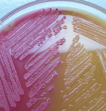 Differential Selective Media Definition Examples Lesson Study