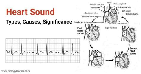 heart sound types causes and significance
