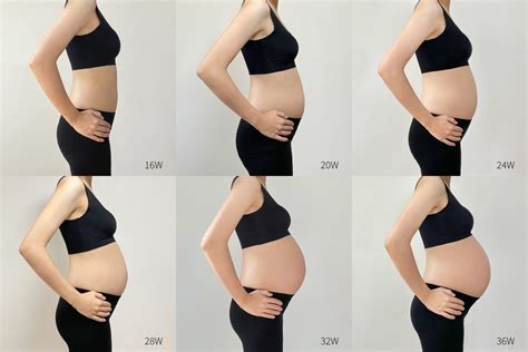 진대산부인과 만삭검사 내진 편도염 임신 36주차 A8