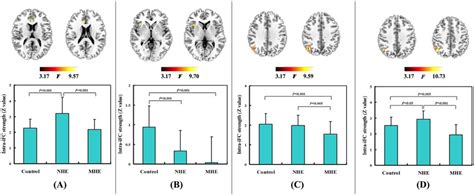 Significant Differences In Intra Network Functional Connectivity Across