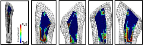 A Model Of Bone Adaptation As A Topology Optimization Process With Contact