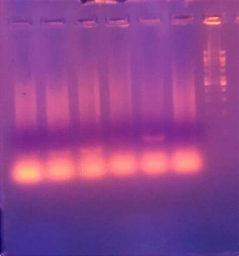 Effect Of Levofloxacin Fabricated Cs Pva Aunc On Dna Fragmentation