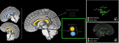 Metrics For Evaluating Spatial Correspondence Between Brain Images