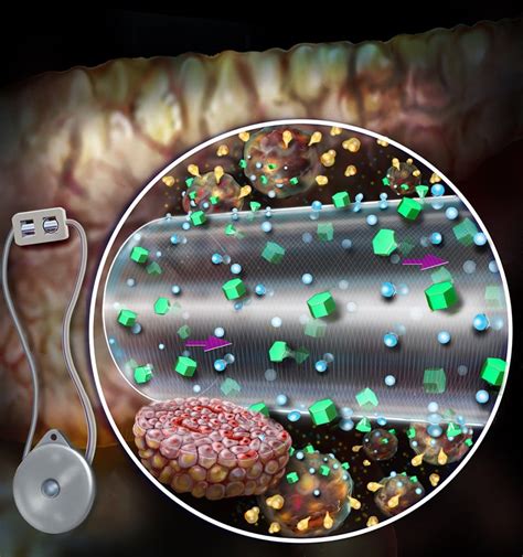 Pancryos Enters Licence Agreement For Macroencapsulation Device